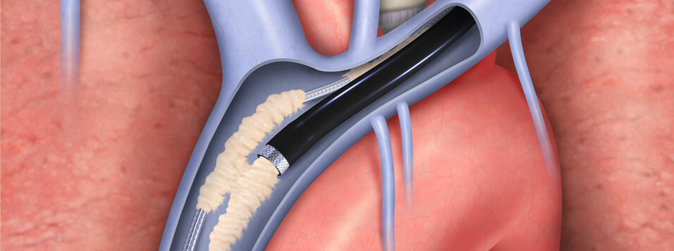 Lead Management | Lead Management