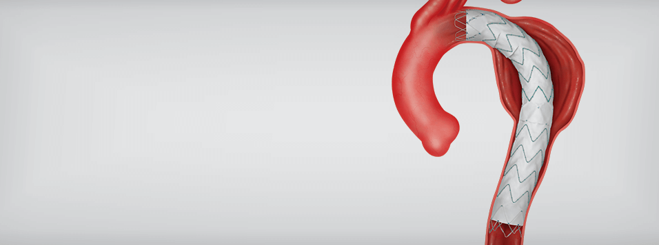 Medical Devices for Minimally Invasive Procedures | Cook Medical