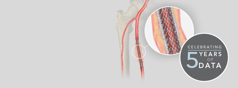 Medical Devices for Minimally Invasive Procedures | Cook Medical