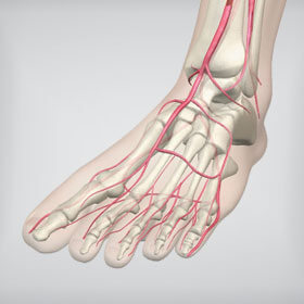 Peripheral Intervention | Cook Medical