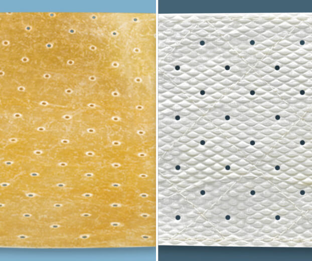 The path from Surgisis to Biodesign | Surgery