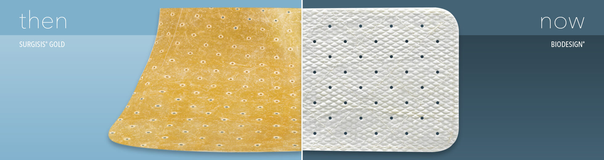 The path from Surgisis to Biodesign | Surgery