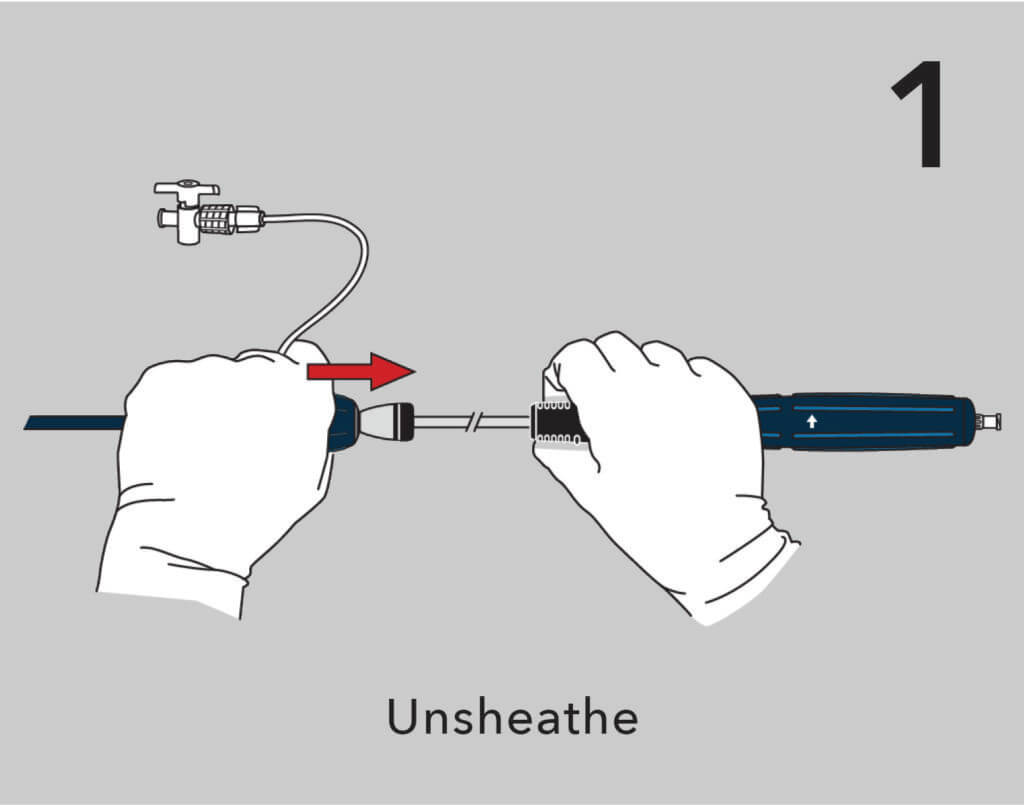 Zenith Alpha® Thoracic Endovascular Graft | Cook Medical