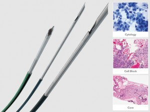 Cytology, cell block or core: results you can see. | Endoscopy